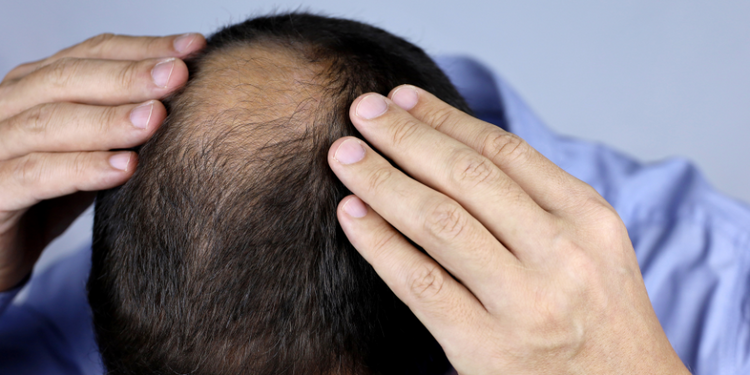 Step One Measure Base Size – HairBro
