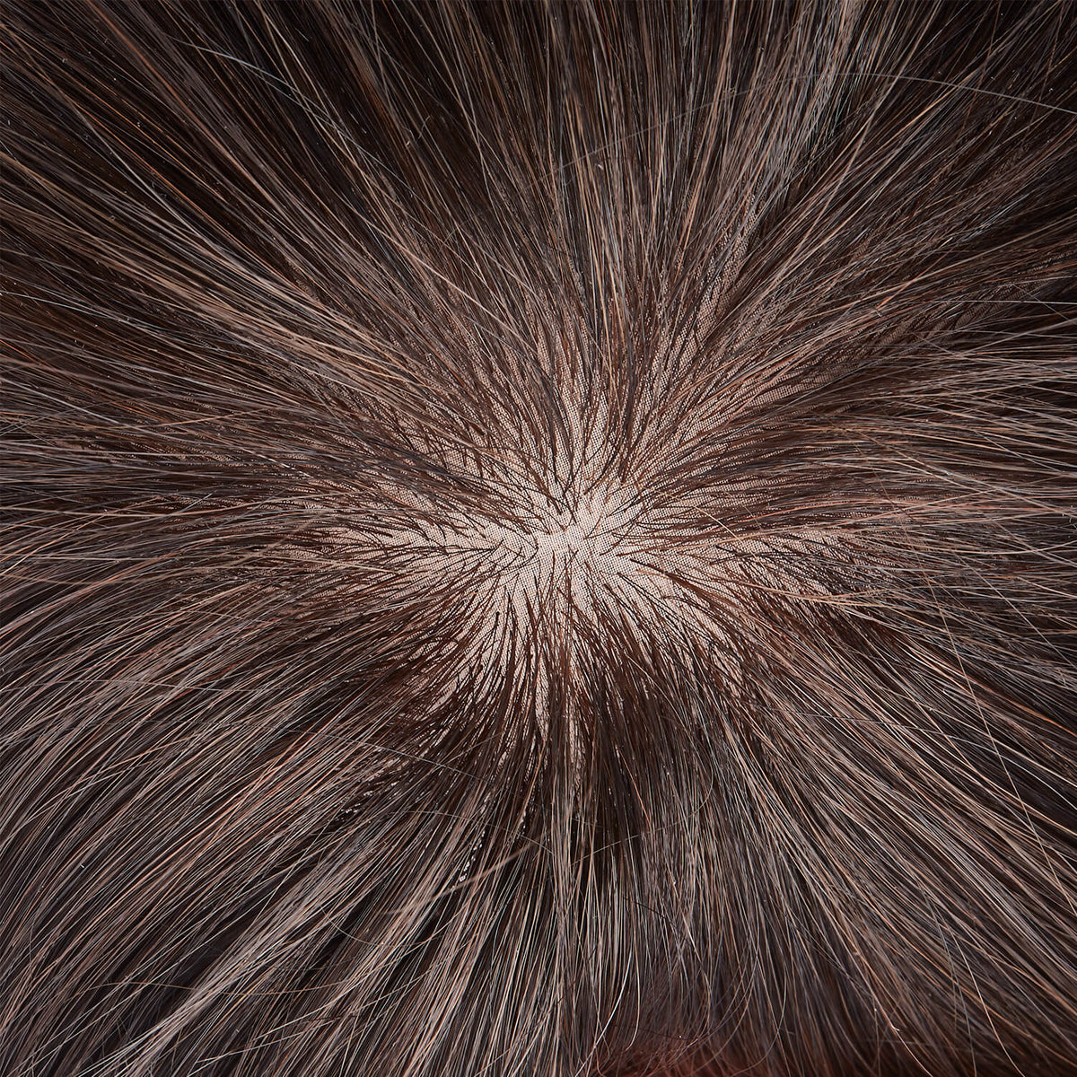 The Injection Lace Center Base Hair System